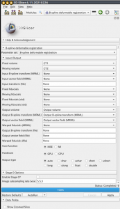 3DSlicerによるDIR: Plastimatch – Takemura Lab.