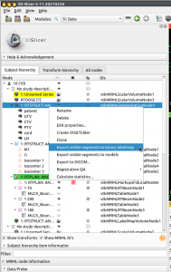 3D SlicerのSegment Statisticsの使い方 – Takemura Lab.